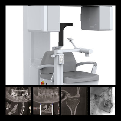 White Color Dental Cone Beam Computed Tomography with Sharp Image
