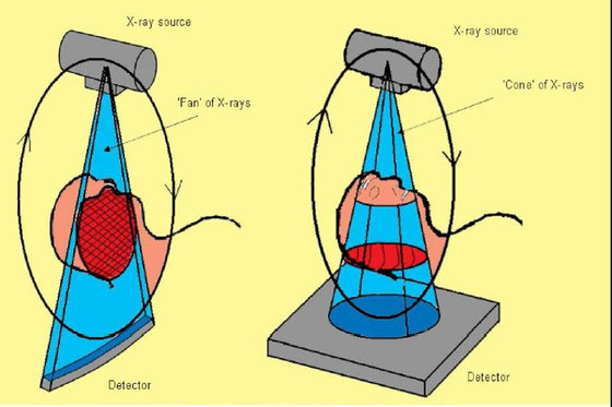 Cone Beam Computed Tomography High resolution Medical Imaging Equipment