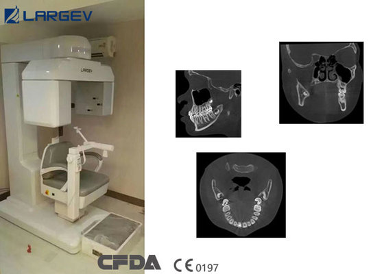 LargeV Hires3D High quality and welll-performing Dental Computed Tomography with Flat Panel Sensor Type