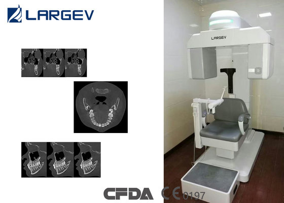 LargeV Hires3D High quality and welll-performing Dental Computed Tomography with Flat Panel Sensor Type