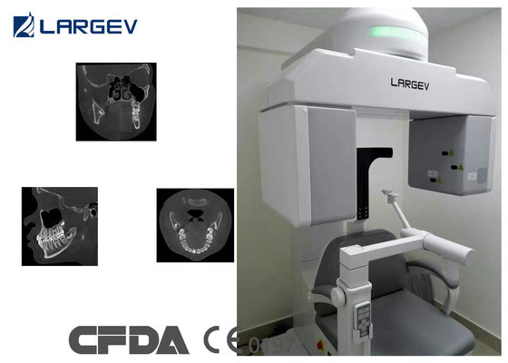 LargeV Hires3D  dental CT scanner  with easy and simple interface and better FOV