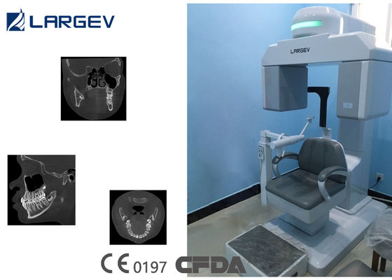 LargeV Hires3D  dental CT scanner  with easy and simple interface and better FOV