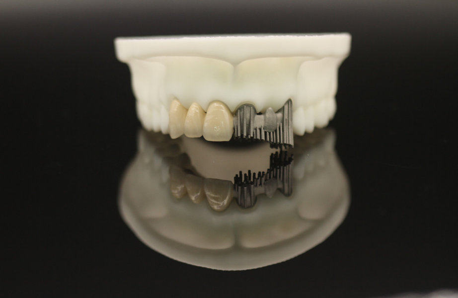 quality Dental Crown Lab factory
