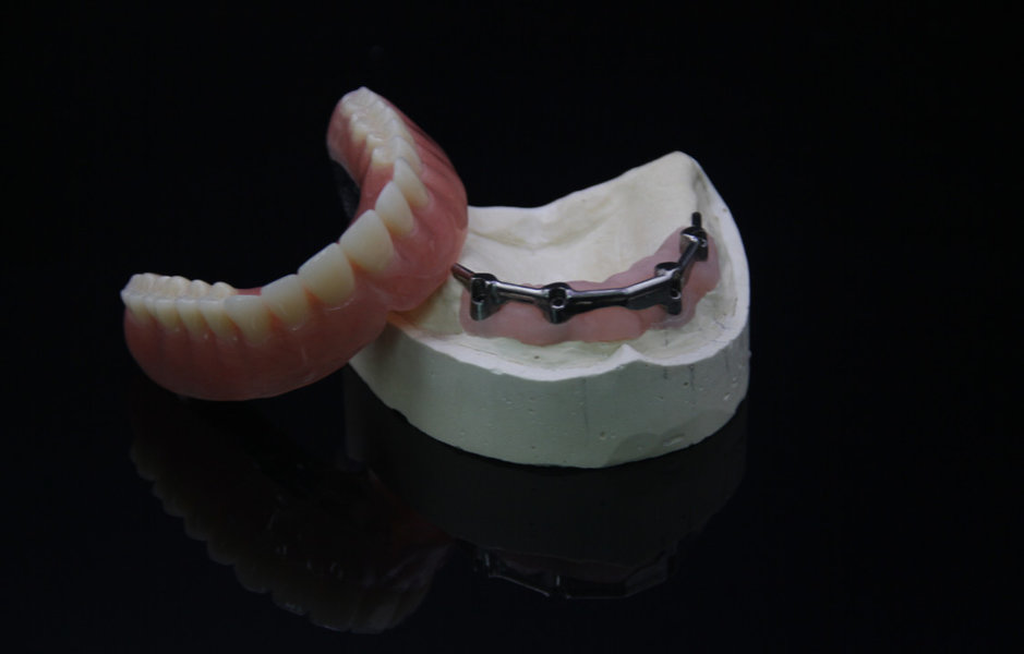 quality Dental Crown Lab factory