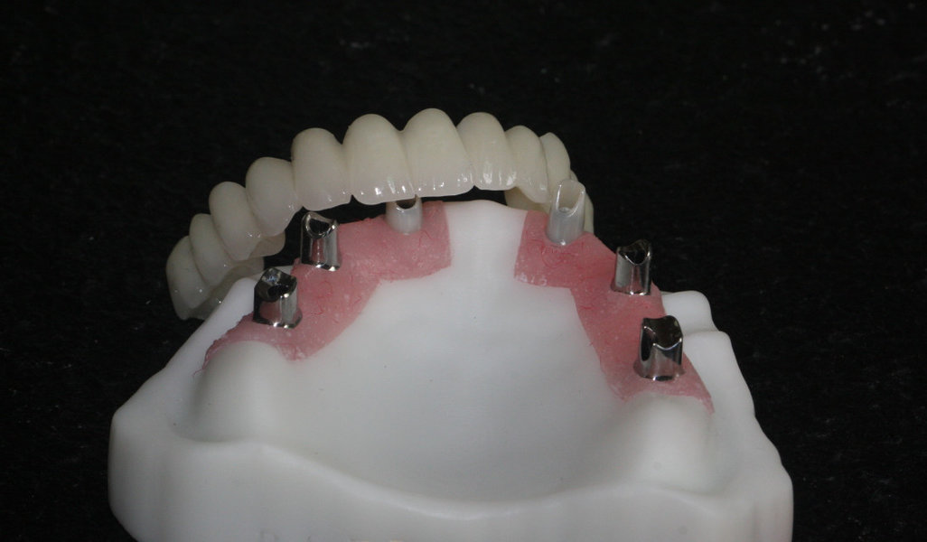 quality Dental Crown Lab factory