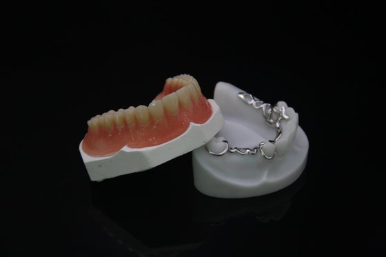 Implant Supported All On 4 Dentures , Implant Bar Precision Attachment For Dental Clinic