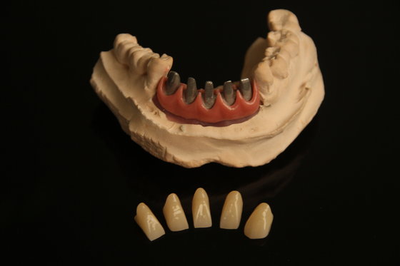 Comfortable Implant Supported Dentures , All On 4 Hybrid Denture For Dental Lab