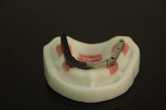 Comfortable Implant Supported Dentures , All On 4 Hybrid Denture For Dental Lab