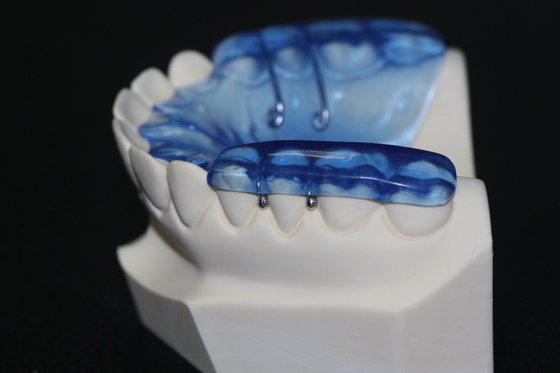Functional Appliances In Orthodontics , Anti - Snoring Device Mouth Guard