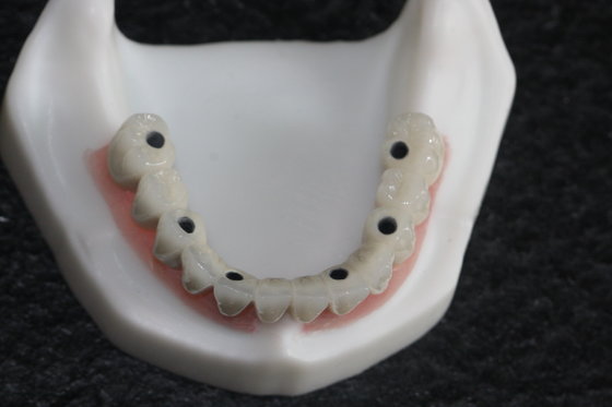 PFM Porcelain Fused To Metal Crown , Temporary / Permanent Bridge For Teeth