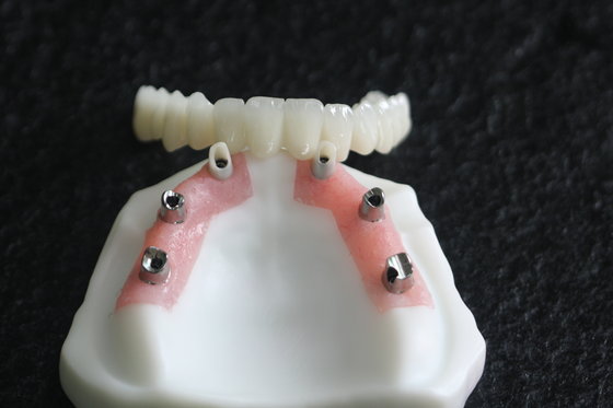 PFM Porcelain Fused To Metal Crown , Temporary / Permanent Bridge For Teeth