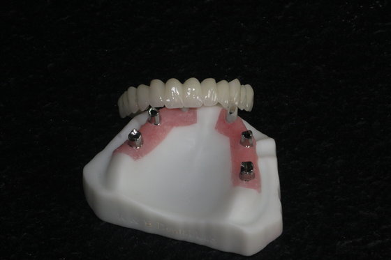 Full Contour Zirconia Dental Crown With CAD / CAM Technology Strong Strength