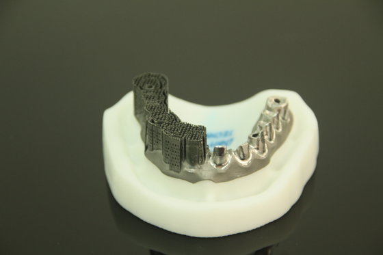 Digital Dental Lab 3D Printing Dental Models For Tooth Crown / Implants High Definition