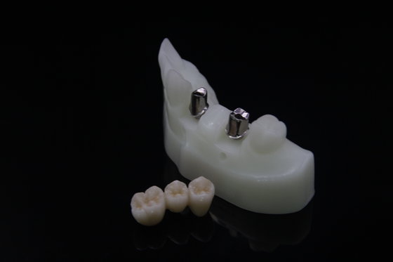 Titanium Dental Implant Abutment And Crown Individually Designed For Dental Clinic