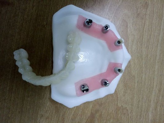Custom Full Contour Zirconia Crowns And Bridges , Fixed Tooth Implant Abutment