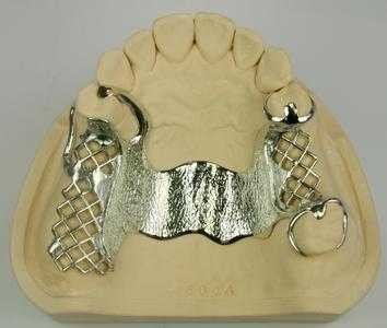 Professional Removable Metal Dental Framework Partial Denture FDA ISO9001 Certification