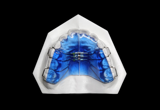 Expansion Straighten Teeth Orthodontic Appliances With Three Dimensional Three Ways