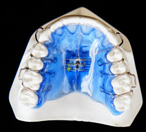 Fan Shade Expansion Dental Orthodontic Appliances Removable To Straighten Teeth