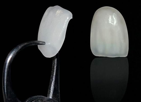 Composite Resin Dental Veneers 0.2MM For Aesthetics Restortion Of Anterior Teeth