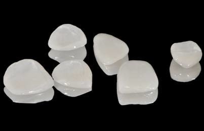 Popular Porcelain Dental Veneers , Dental Ceramic Veneers Virtually Undetectable