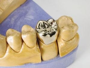 High Noble Metal Full Cast Crown , Single Tooth Metal Dental Tooth Crown