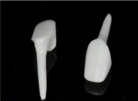 Strong Hardness Pfm Dental Full Ceramic Dental Post and Core