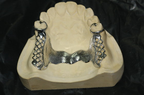 Comfortable Cast Metal Framework For Partial Dentures , Dental Laboratory Frameworks