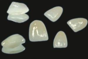 0.3mm Natural Dental Teeth Porcelain Veneers With Exellent Biocompatibility