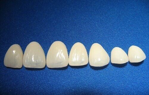 Stain Resistant Porcelain Dental Veneers For Teeth with Natural Tooth Appearance