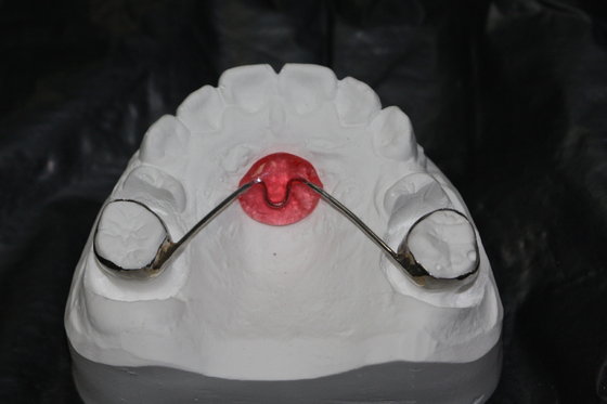 Invisible Bottom Teeth Dental Retainer , Teeth Fixed Orthodontic Appliances
