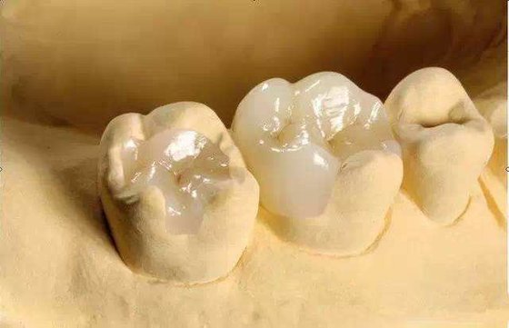 Metal Pure Titanium Alloy Composite Dental Crown , Composite Tooth Veneers