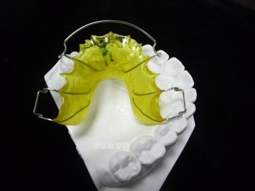 Two Dimensional Arch Expansion Orthodontic Appliances，Mouth Wire Retainer For Teeth