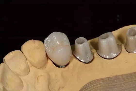 Zirconium Dioxide Tooth Implant Abutment , Zirconia Dental Custom Abutment