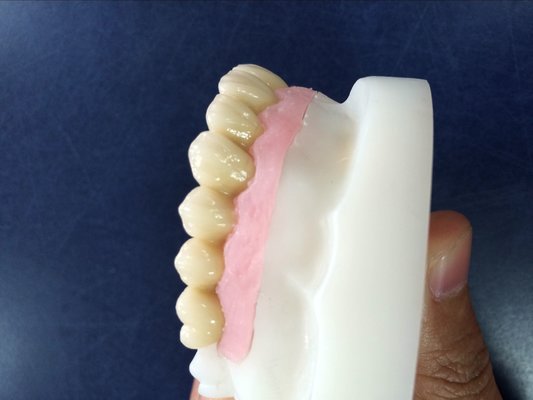 Customized Dental Lab Zirconia Crowns For Front Teeth All Teeth CAD / CAM Technology