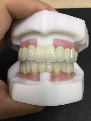 Zirconia Dental Crown Fixed Dental Implant Bridge For Denture Hospital / Clinic