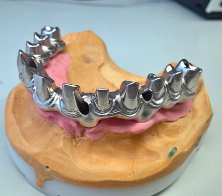 Pure Titanium Dental Implants Crowns , Full Mouth Titanium Implants Teeth