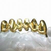 Intensity Restoration Dental Crown Lab Captek Naogold Dental Bridge In Dentistry