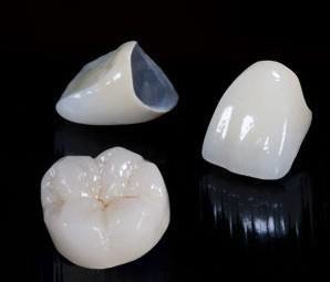 Beautiful Dental Crown Lab PFM Bridge And Caps For Teeth No Side Effect