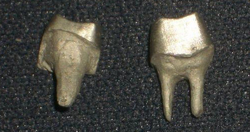 Yellow Gold PFM Dental Crown Lab Dental Post And Core Good Strength
