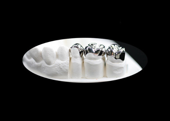 High Grade Cobalt And Chromium Alloy Inlays For Teeth , Composite Inlays And Onlays
