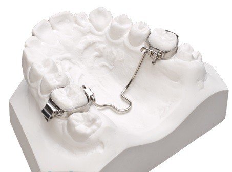 Dental Mouth Retainer To Fix Teeth , Permanent Teeth Retainer For Dental Lab