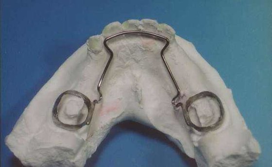 Traditional Wrapping Round Retainer , Teeth Straightening Dental Orthodontic Appliance