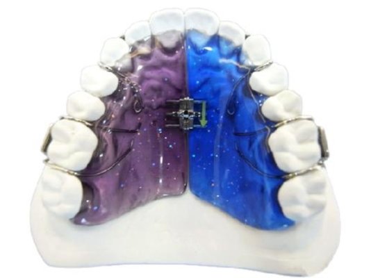 Dental Orthodontic Appliances Half Open Activator With Screw For Crooked Teeth