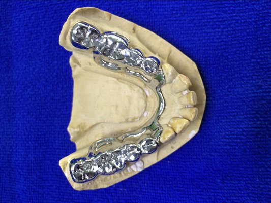 Opening Deep Bite Open Activator Orthodontic Appliances For Adults Teeth Treatment