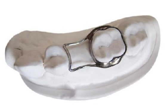 Metal Bottom Mouth Orthodontic Dental Retainer For Teeth Gap Removable