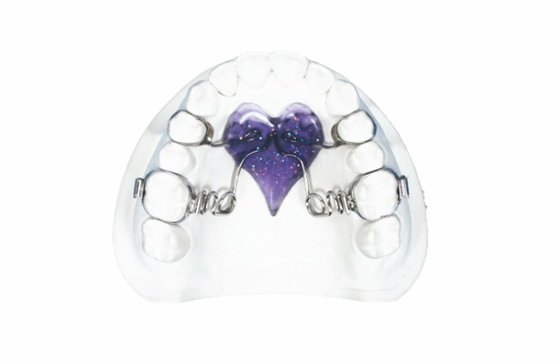 Retention Spring Removable Orthodontic Appliances With Routine Oral Hygiene Procedures