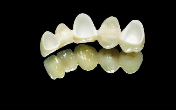 Health Restoration High Performance Polymer Biohpp Bredent High Stiffness