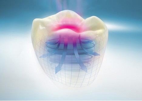 Permanent BIOHPP Dental Tooth Crown With Good Biocompatibility Health Restoration