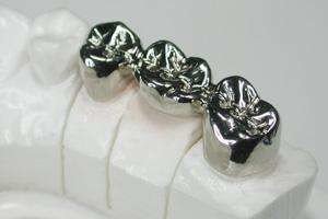 Palladium Silver Full Cast Metal Crown 100% Metal Construction High Intensity