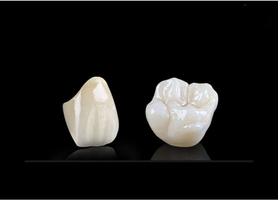 Adhesive Glass Porcelain Dental Crown And Bridge For Front Tooth High Density